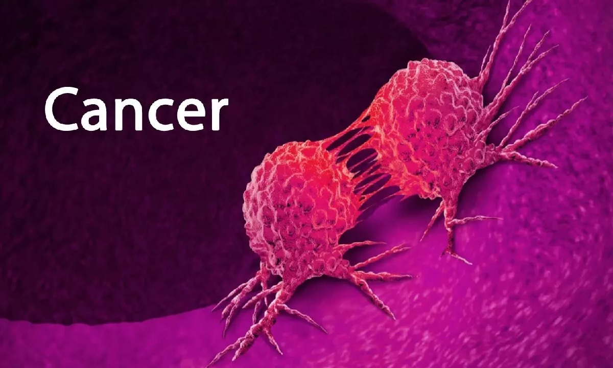 ‘Lifestyle, not just genetics, driving rising cancer burden in Kashmir ...